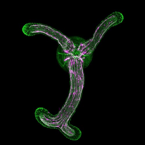 Nematostella Hox gene function